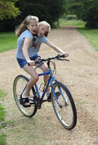 Abby and Brittany Hensel - Conjoined Twins